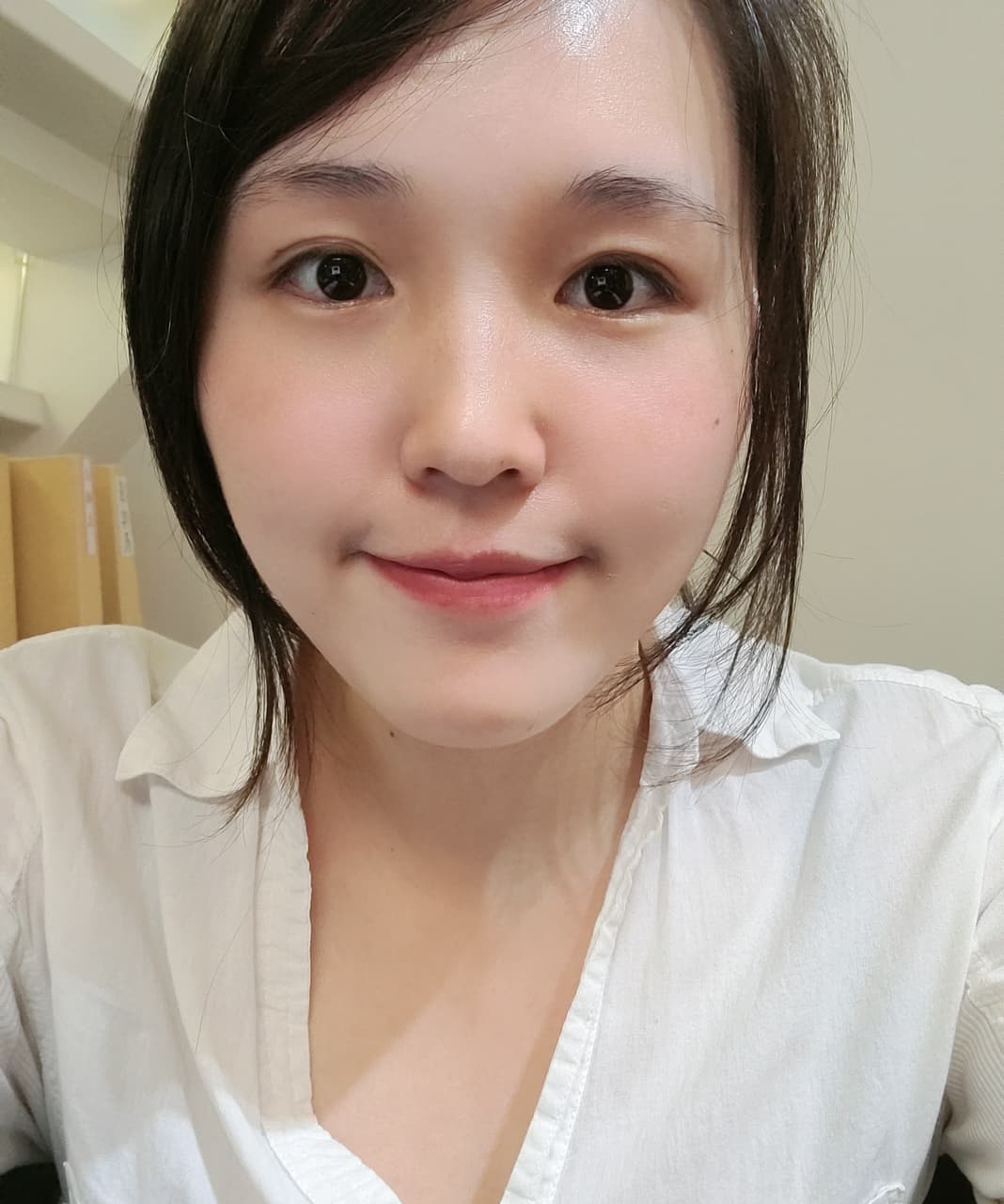 #詢問 #分享 正顎手術術後朝天鼻 - B14 留言 | Dcard