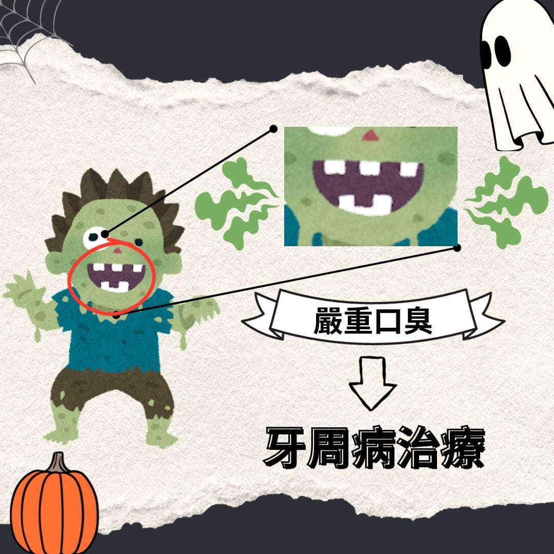 Trick or Treatment! - 馬鈴薯牙醫 (@potatoali) | Dcard