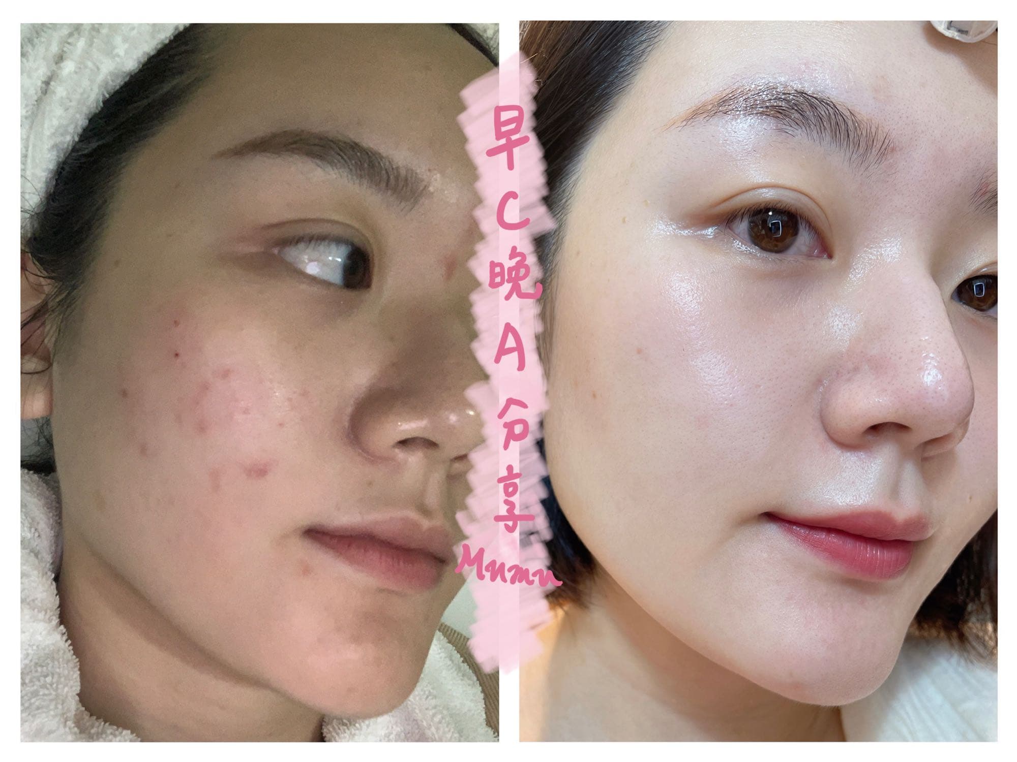 #分享 早C晚A 5個月膚質提升有感分享#自我投資 - 美妝板 | Dcard