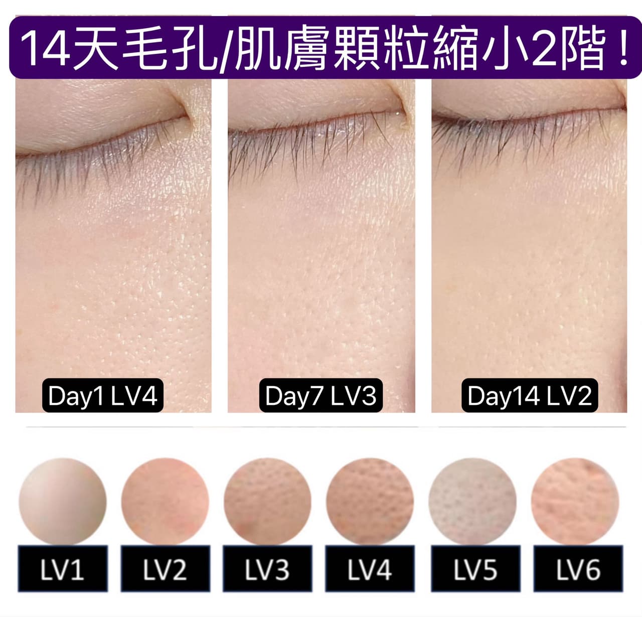 一滴修復粗糙肌!青春密碼酵素肌底調理精華14天實測 ft.巴黎萊雅 - 木木 (@dmlu) | Dcard