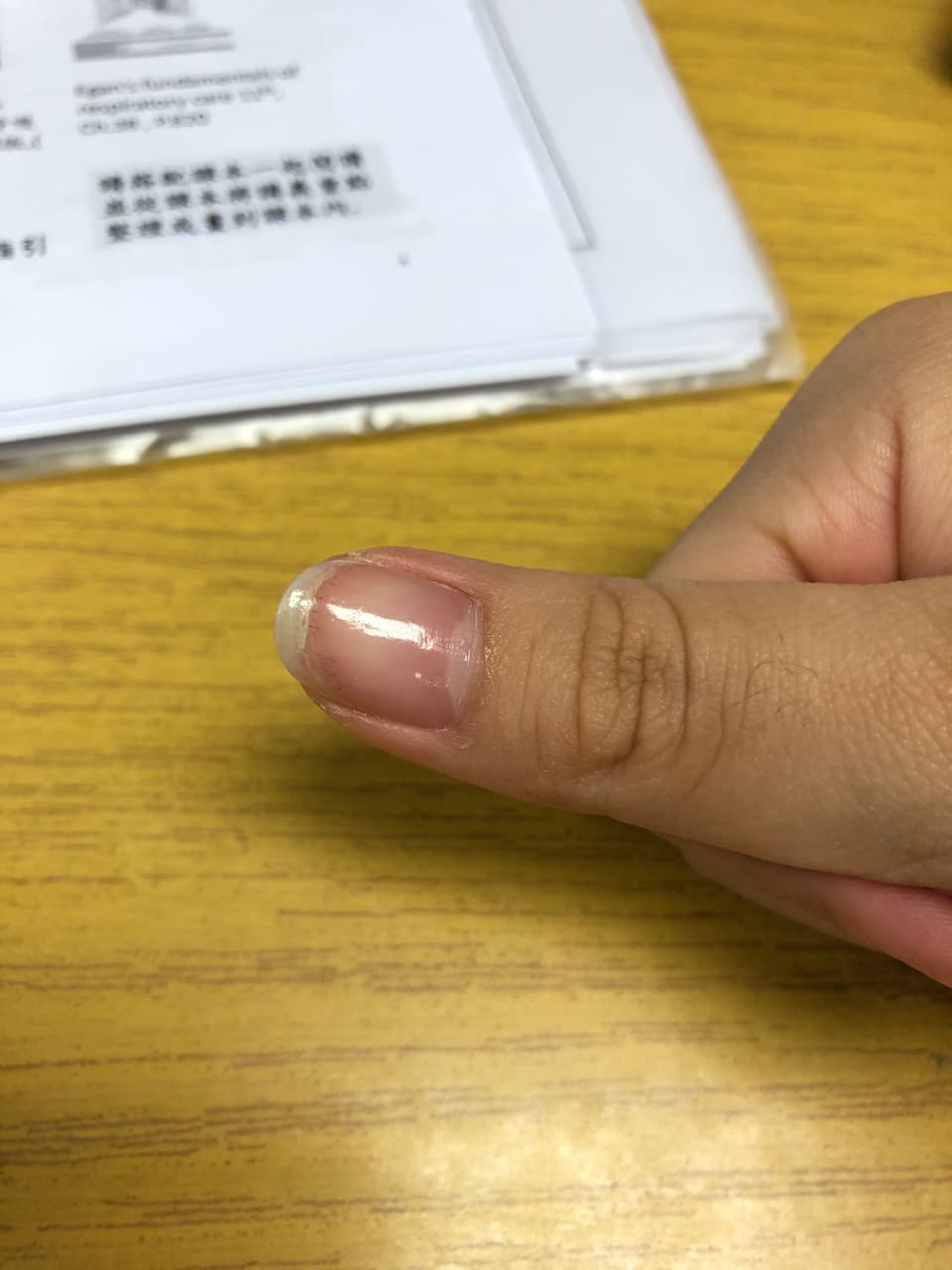 請益 卸甲後 美甲板 Dcard