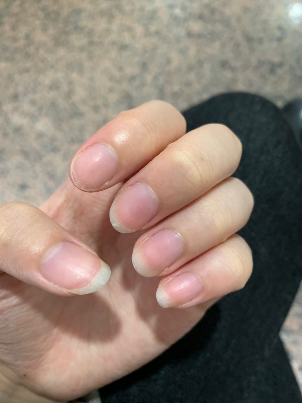 問題 請問這是什麼造成的?已解決 美甲板 Dcard