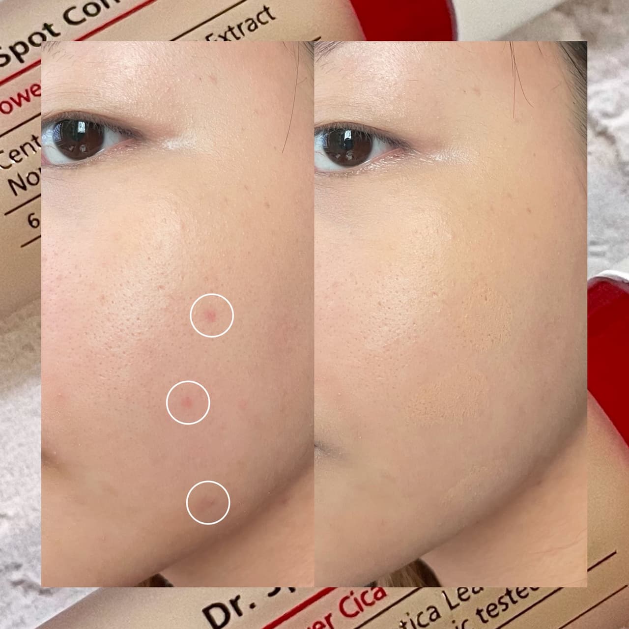 #分享 愛用遮瑕MEDI247 - 美妝板 | Dcard