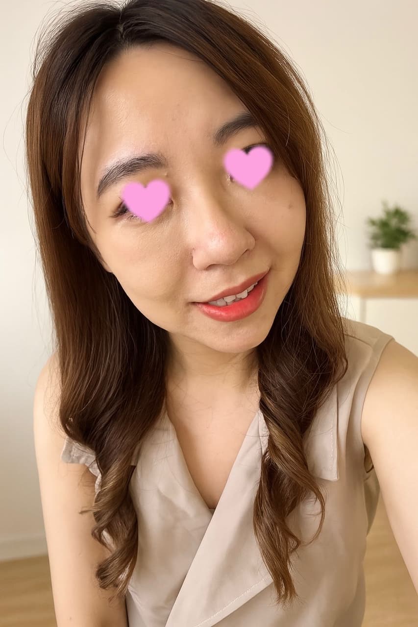 #分享 台北悅x) 得美微針筆 + PRP 改善痘痘＆痘印｜分享療程過程與效果 - 醫美板 | Dcard