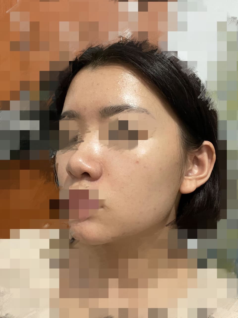 #分享 油肌！Stridex水楊酸棉片和medi247魚腥草分享 - 美妝板 | Dcard