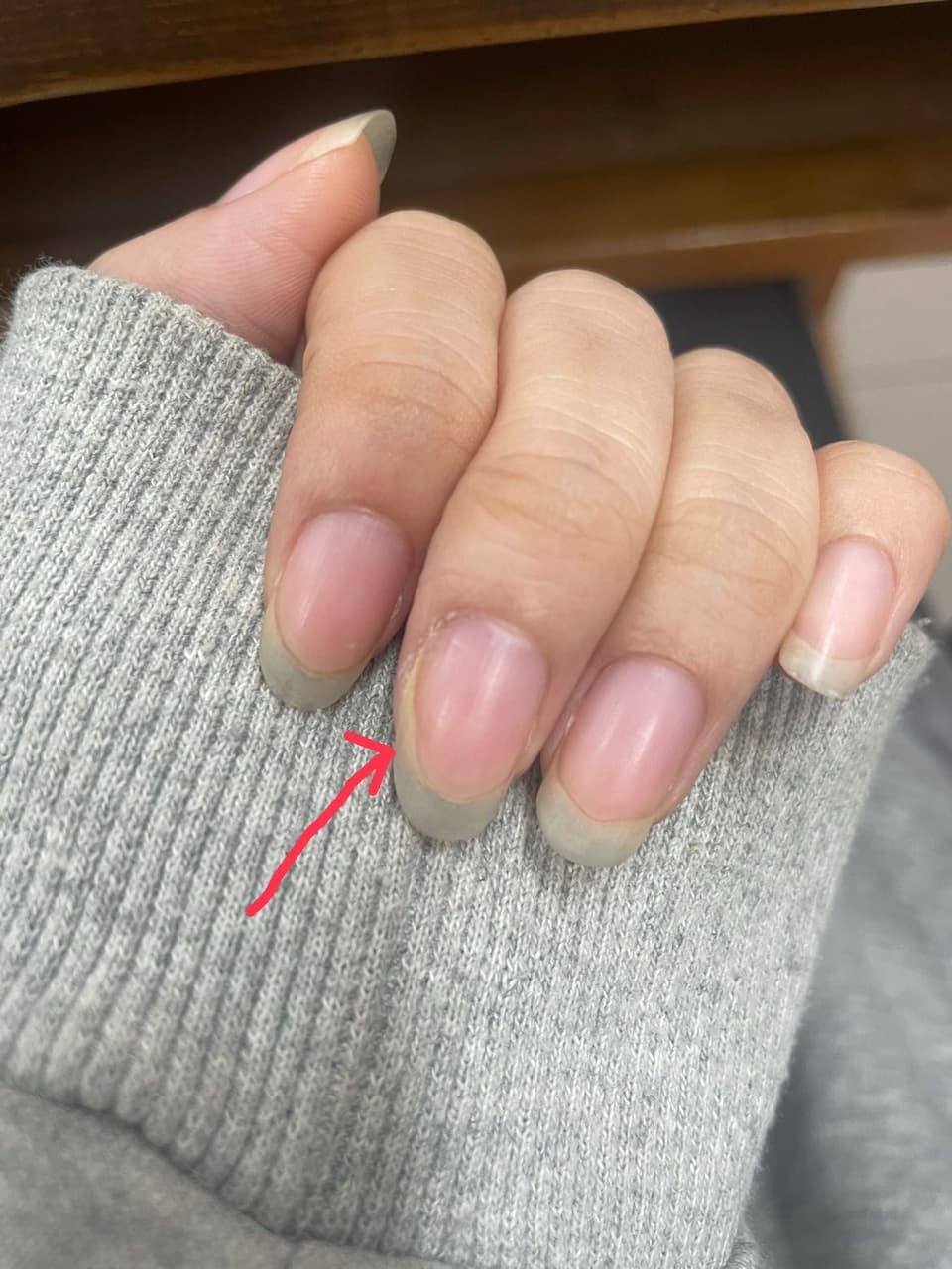 問題 想問這樣指甲的問題是什麼 美甲板 Dcard