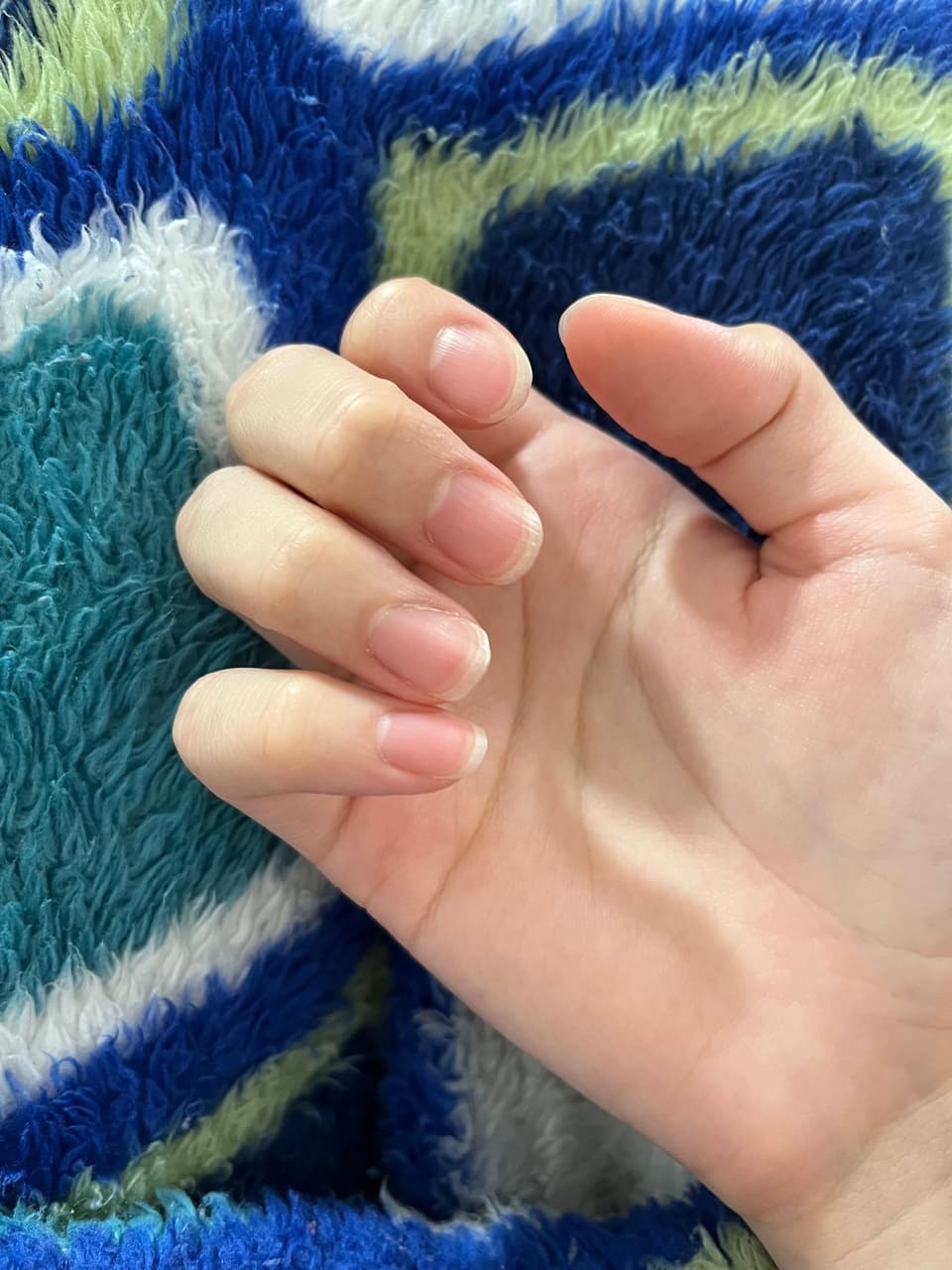 問題 手指變形能做美甲嗎 美甲板 Dcard
