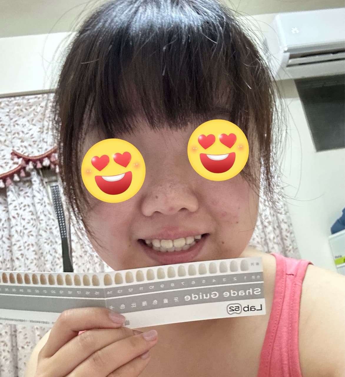 大推👍Lab52齒妍堂｜美白淨齒組 - 購後評價板 | Dcard