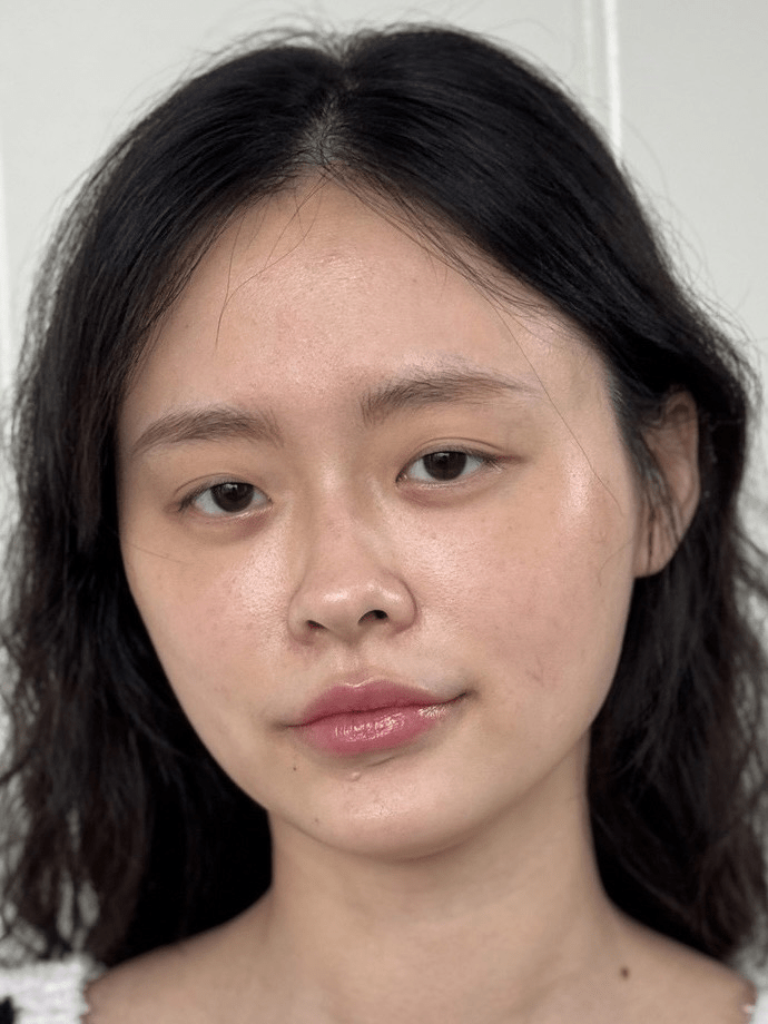 別再狂貼雙眼皮貼！八字縫省時又持久💡我的術前後全紀錄 - 品牌商家 (@brand_selection) | Dcard