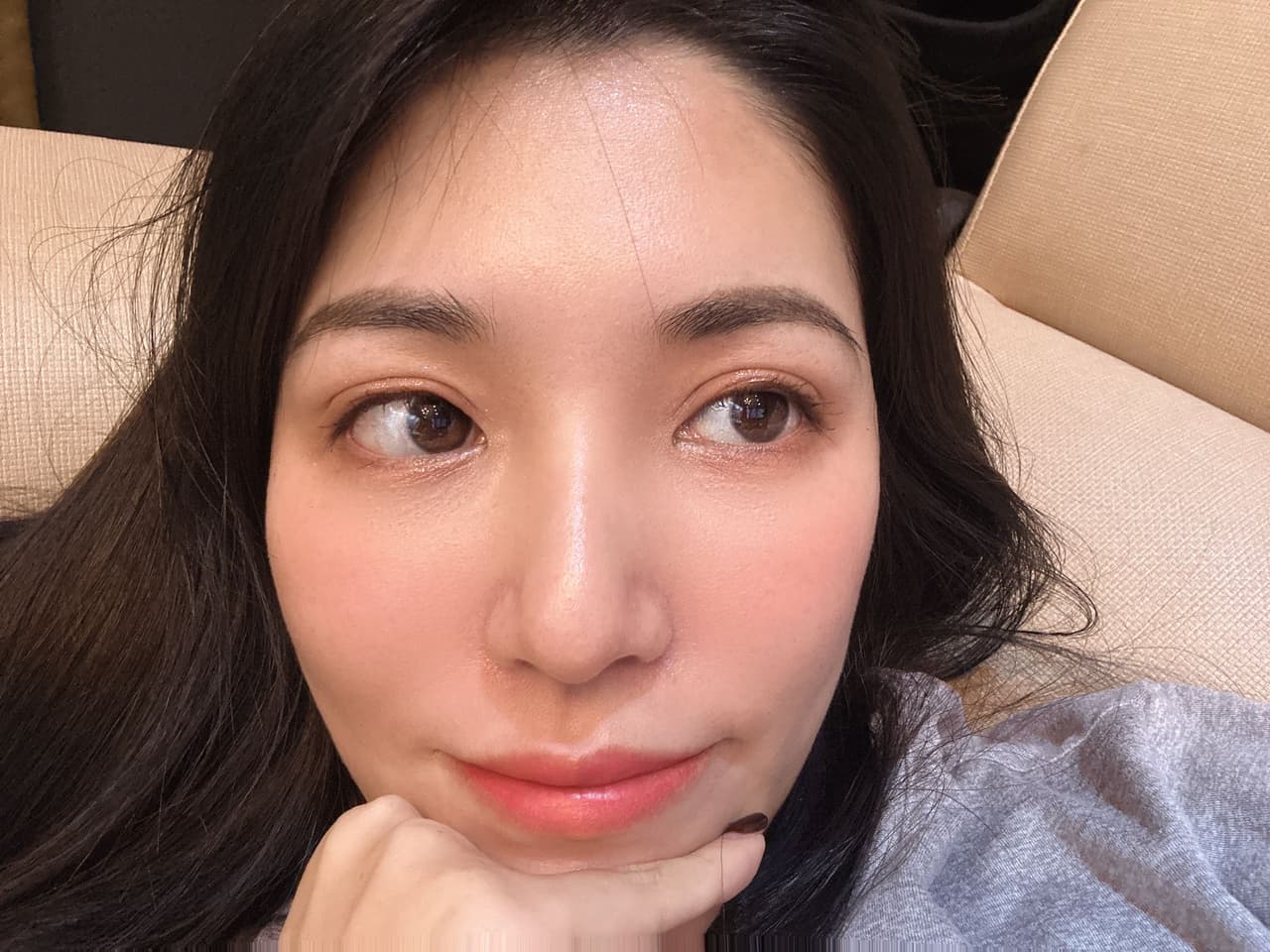 #分享 重修縫雙眼皮心得陳x農（有圖/滿兩週分享+諮詢心得） - 醫美板 | Dcard