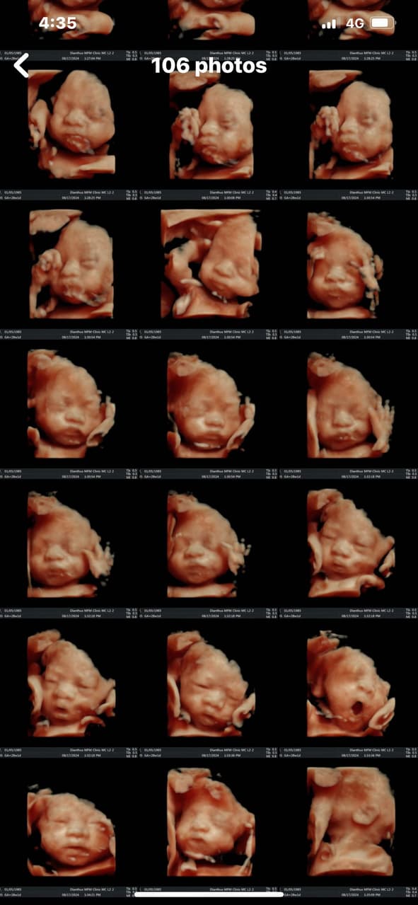 #懷孕 #分享 超好玩的 3D+4D超音波 胎兒寫真 - 親子板 | Dcard