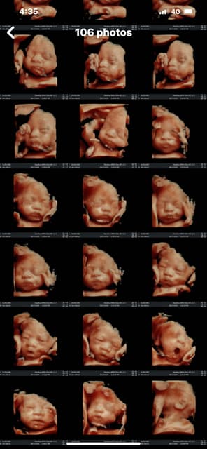 #懷孕 #分享 超好玩的 3D+4D超音波 胎兒寫真 - 親子板 | Dcard