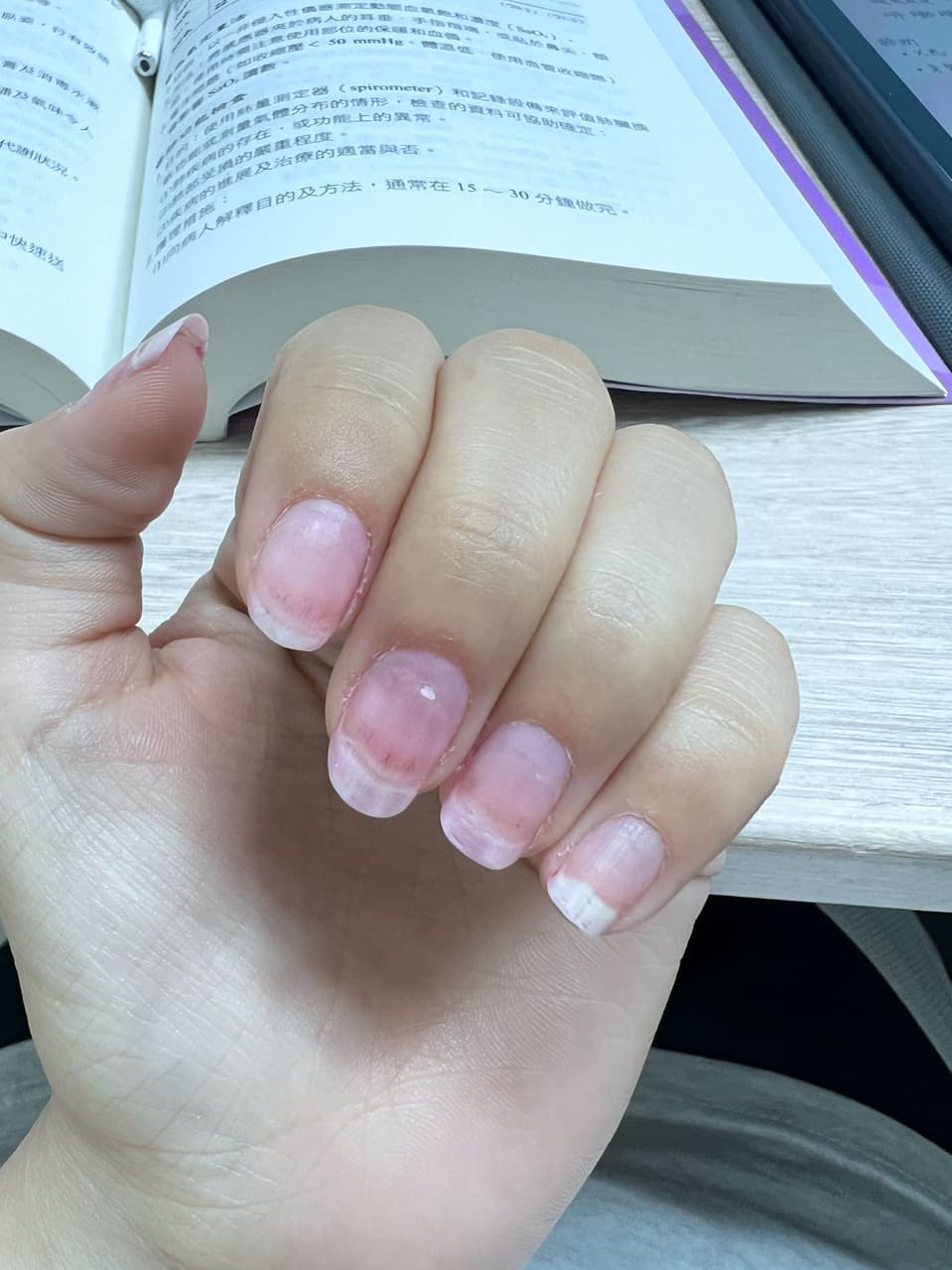 問題 這樣是卸甲卸過頭嗎 美甲板 Dcard