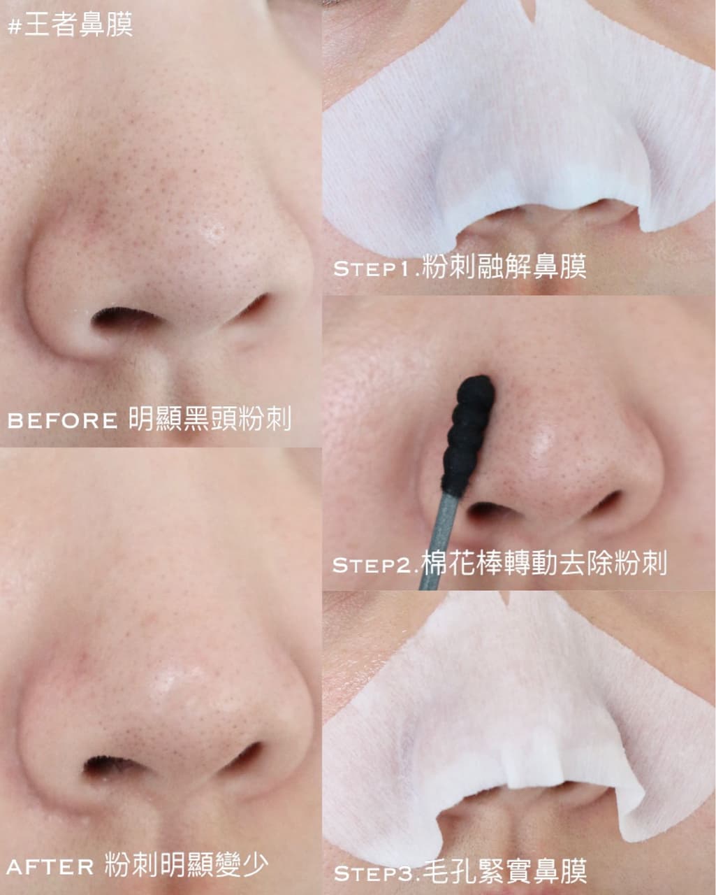 和黑頭粉刺徹底分手！👋🏻韓國CNP泡泡鼻膜＆王者鼻膜🇰🇷👑 - 名妤 Mingyu (@catcat_0800) | Dcard