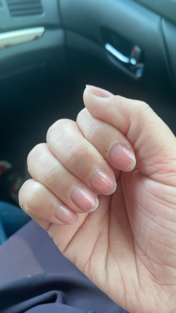 兩個月的光療指甲卸甲後 美甲板 Dcard