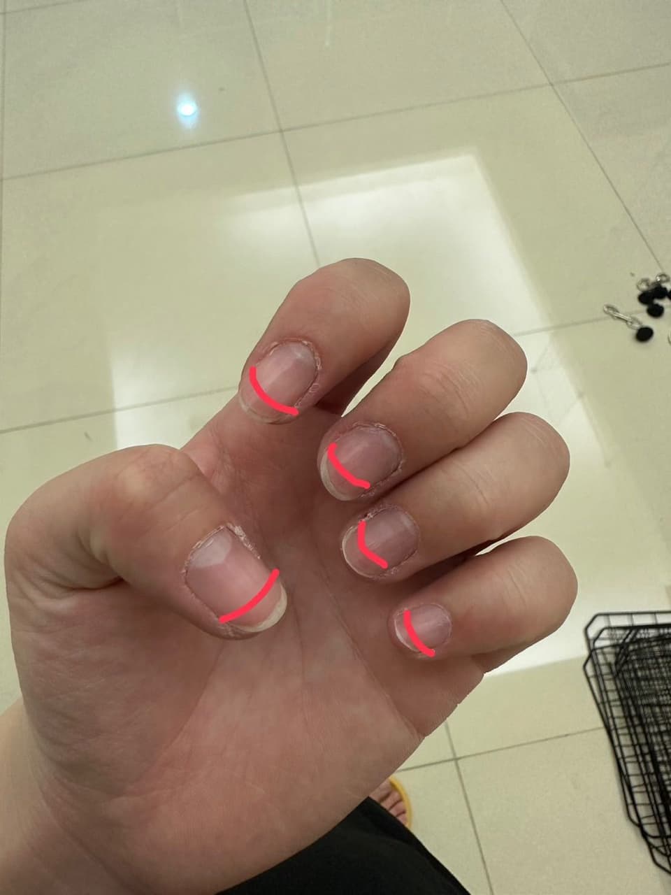 問題 請問甲床分離 ?! 美甲板 Dcard
