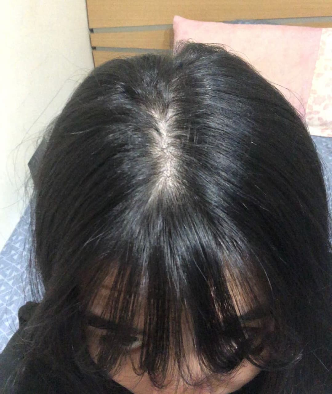 求助 這樣算禿頭嗎😭 - 女孩板 | Dcard