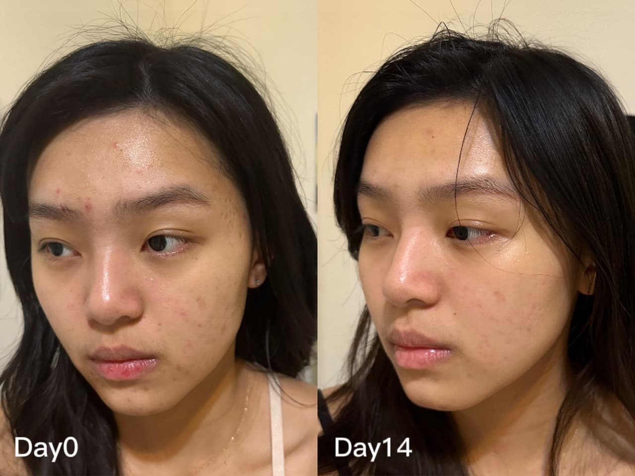 保濕做好粉刺不上身！feat.The Body Shop - 快樂的瓜農 (@emmaho) | Dcard