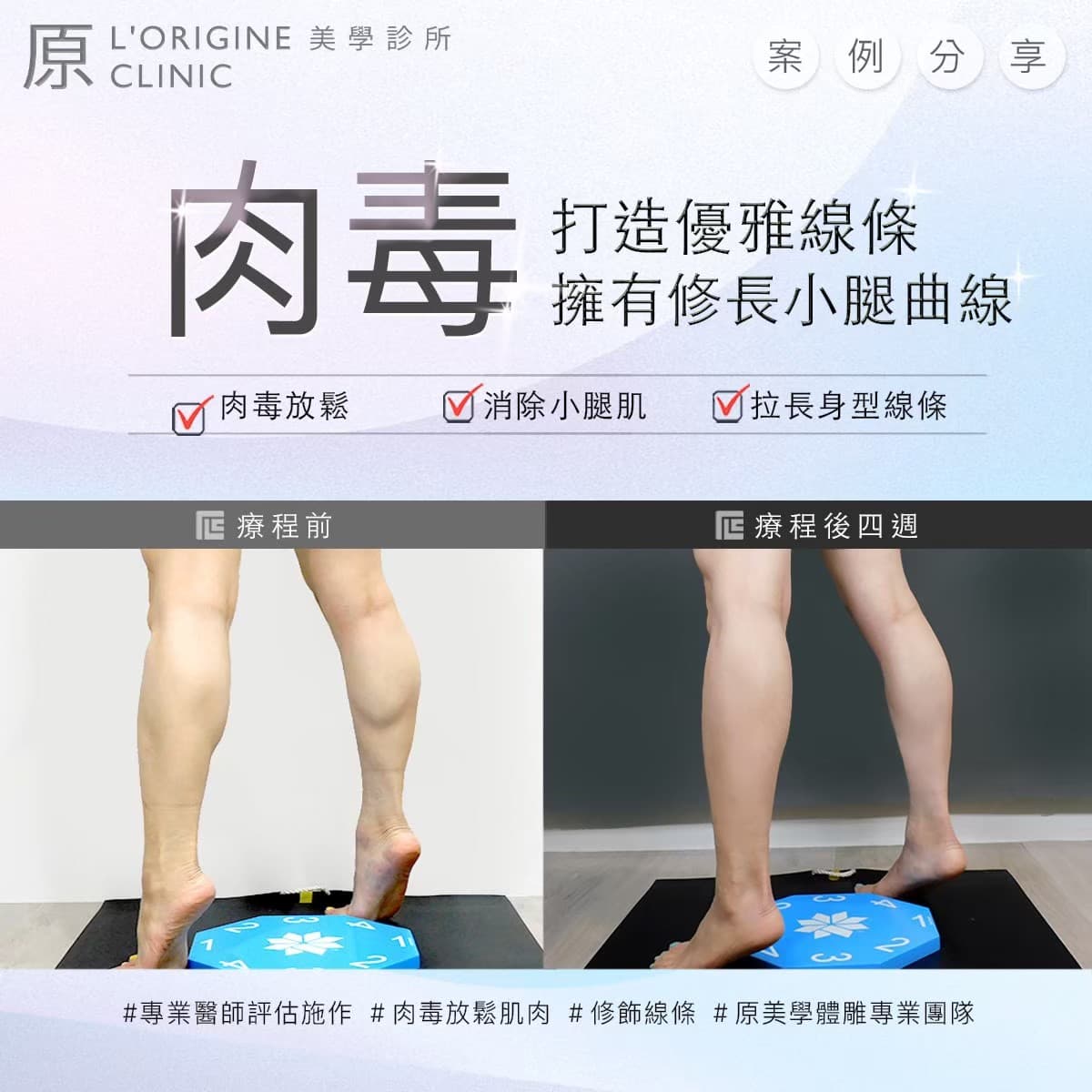 #分享 肉毒桿菌素打造纖長線條 - 原美學診所 (@lorigine) | Dcard