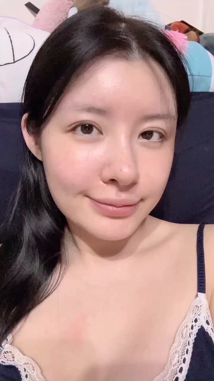 韓國整形滿1個月啦>𖥦