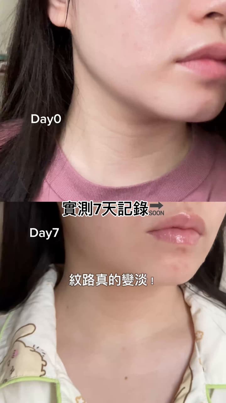 你也低頭滑手機滑到有頸紋了嗎？我！就是！😩 - 白白胖胖愛麗兒 (@nicky_xuan) | Dcard