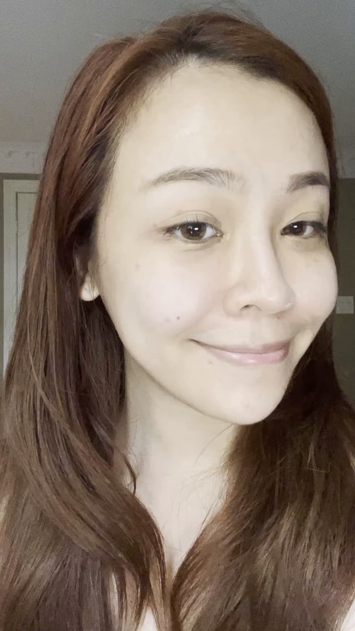 #愛美金句 人生不是天生♥️PRP自體生長因子過程+心得 - 自由媳 (@freeee_na) | Dcard