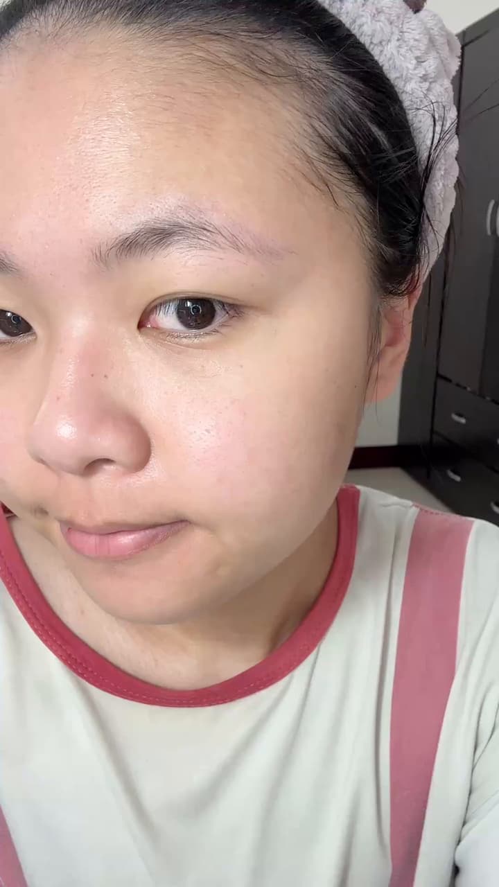 【乾肌救星】我去打了水光針｜全流程分享 - 兔老ꪔ̤̥ꪔ̤̮ꪔ̤̫ (@old_rabbit) | Dcard